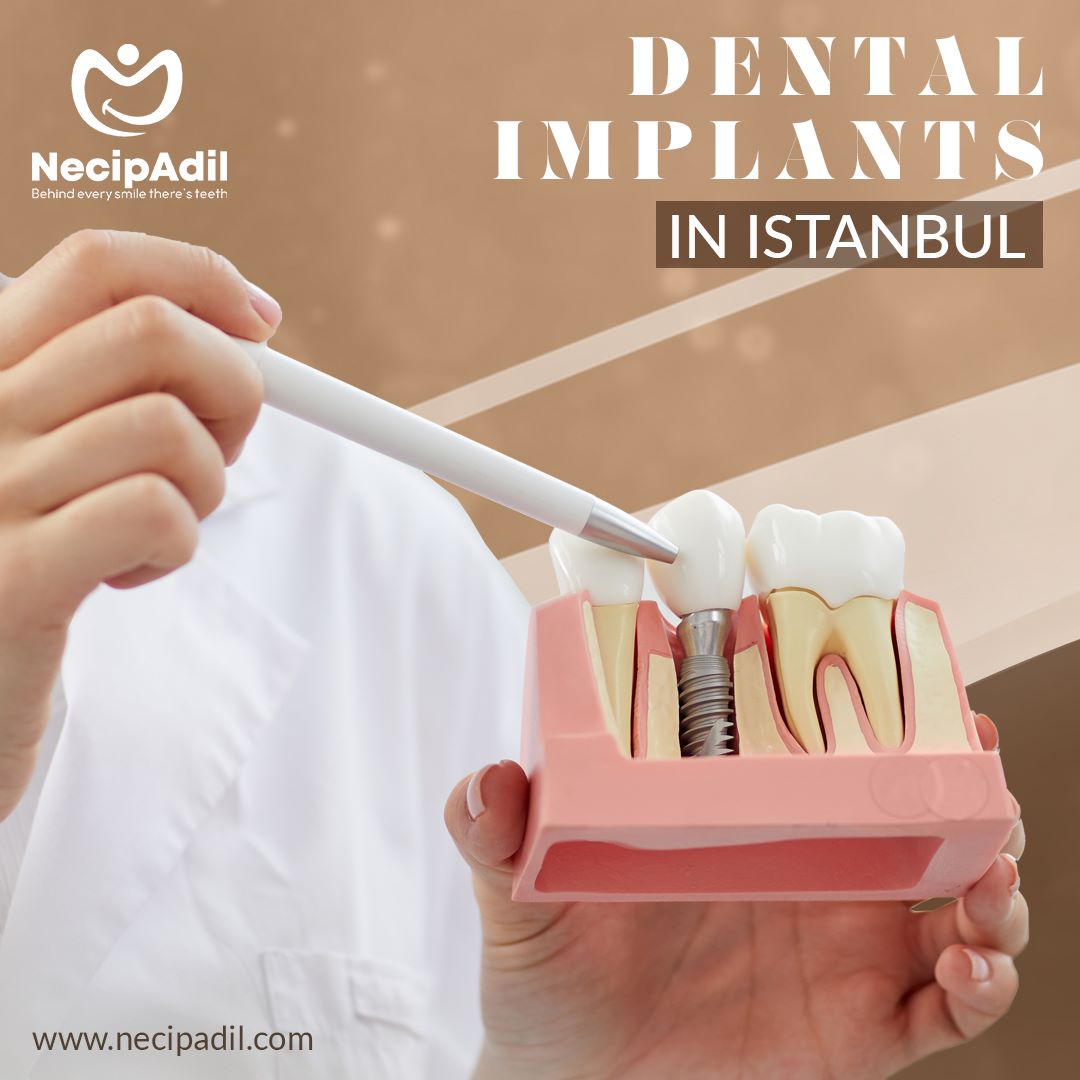 Dental implants in Turkey - Dr.Necip Adil